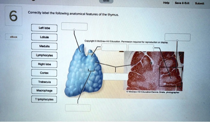 Saved Help Svet Submit 6. Correctly label the following anatomical ...