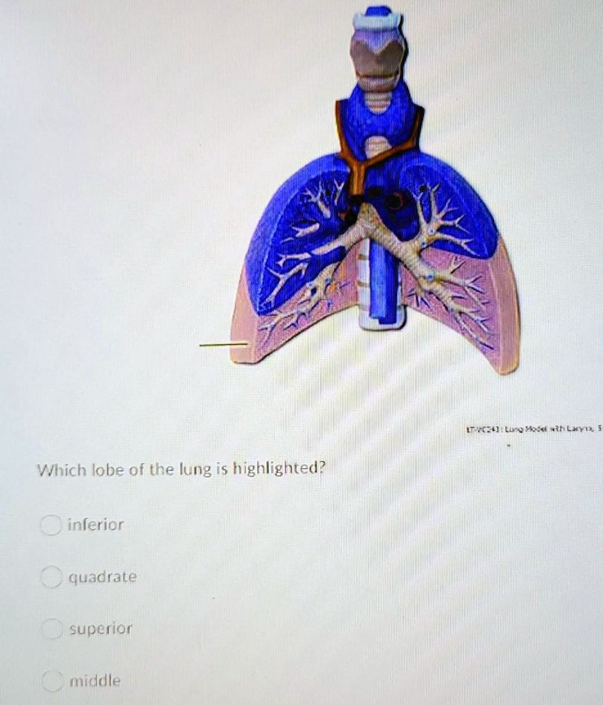 SOLVED: Which lobe of the lung is highlighted? inferior quadrate ...