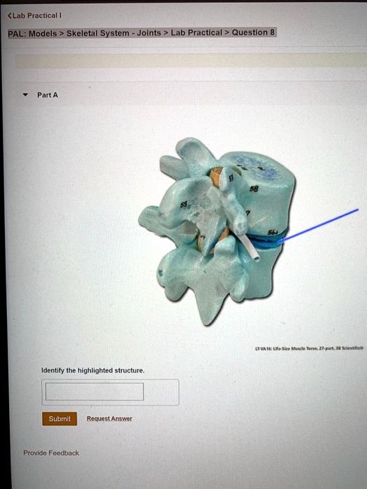 SOLVED: Lab Practical PAL: Models - Skeletal System Joints Lab ... SOLVED: Lab Practical PAL: Models - Skeletal System Joints Lab ...