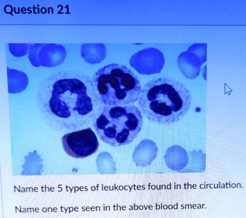SOLVED: Question 21 Name the 5 types of leukocytes found in the ...