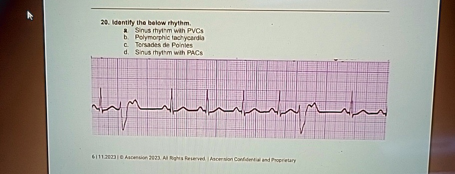 20 identify the below rhythm a sinus rhythm with pvcs b polymorphic ...