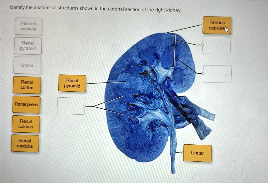 Identify the anatomical structures shown in the coronal section of the ... Identify the anatomical structures shown in the coronal section of the ...
