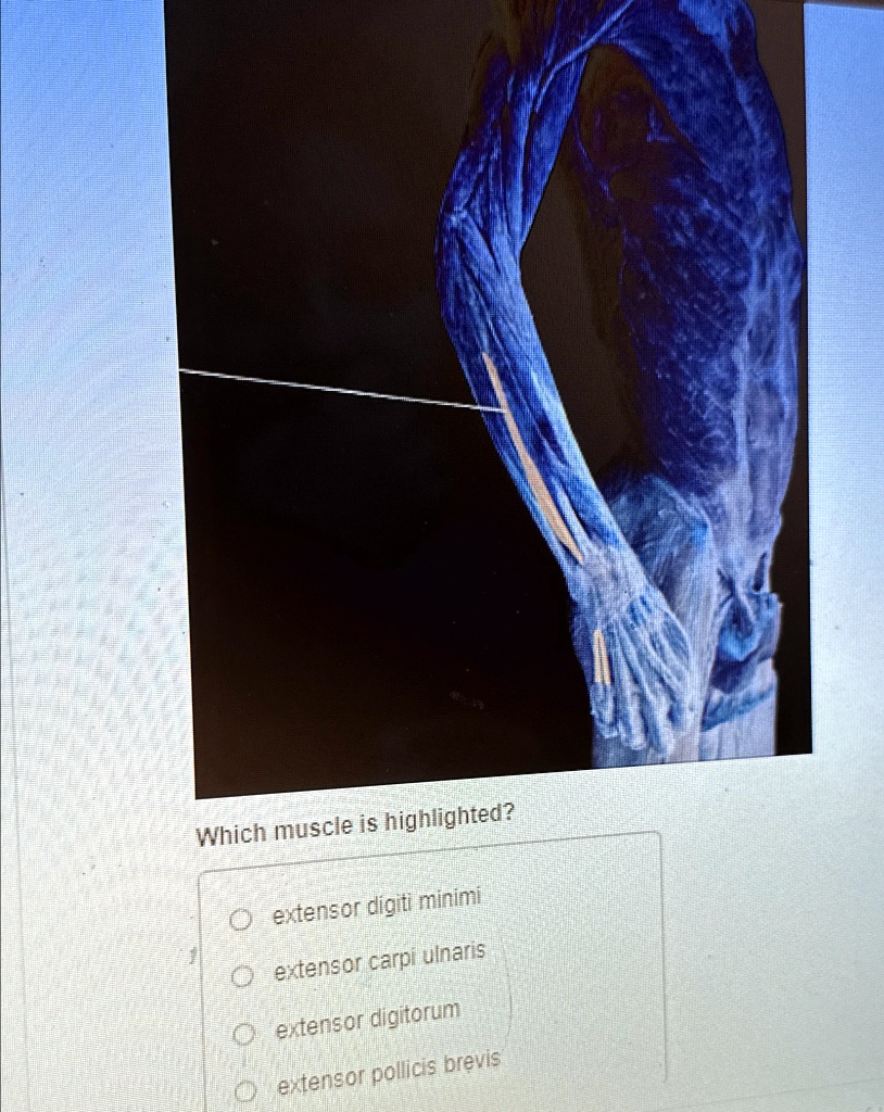 SOLVED: Which muscle is highlighted? - extensor digit minimi - extensor ...