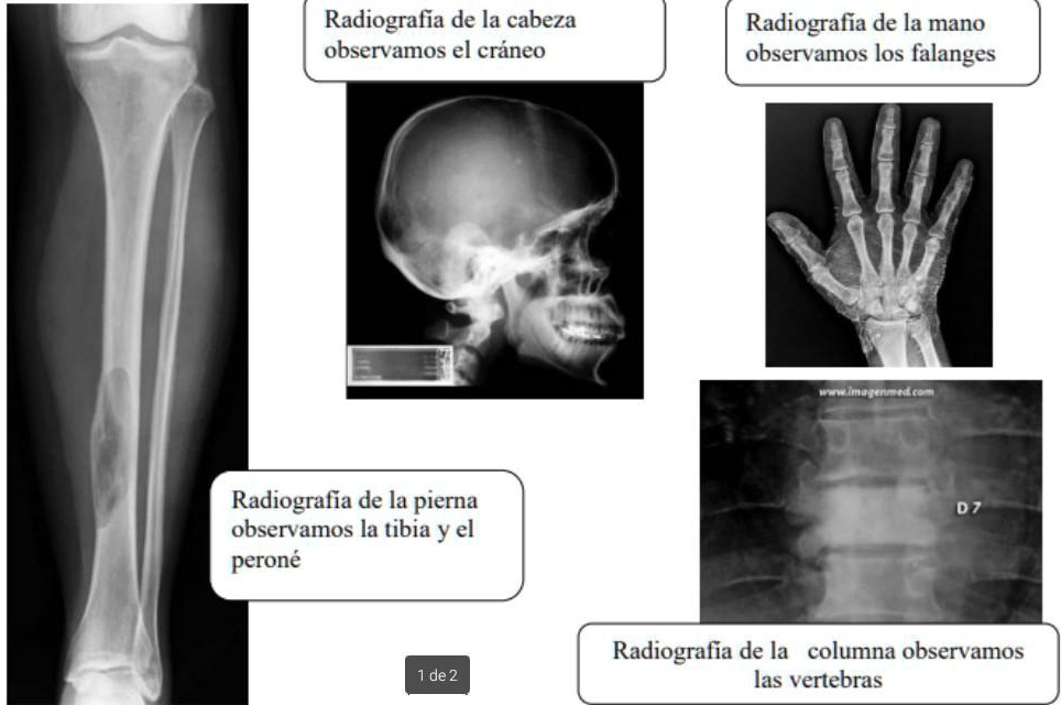 SOLVED: ¿Las imágenes observadas anteriormente nos proporcionan ...