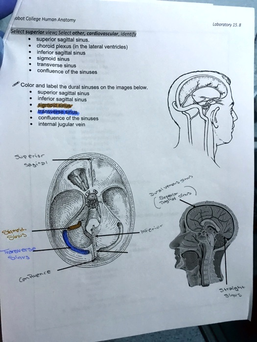 SOLVED: About College Human Anatomy: Select superior view; Select other ...