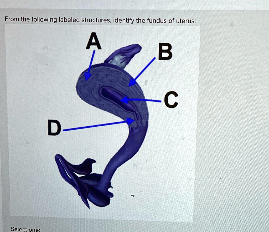 From the following labeled structures, identify the fundus of uterus: A B C D Select one: