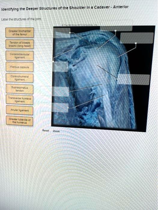 Solved Identifying The Deeper Structures Of The Shoulder In A Cadaver
