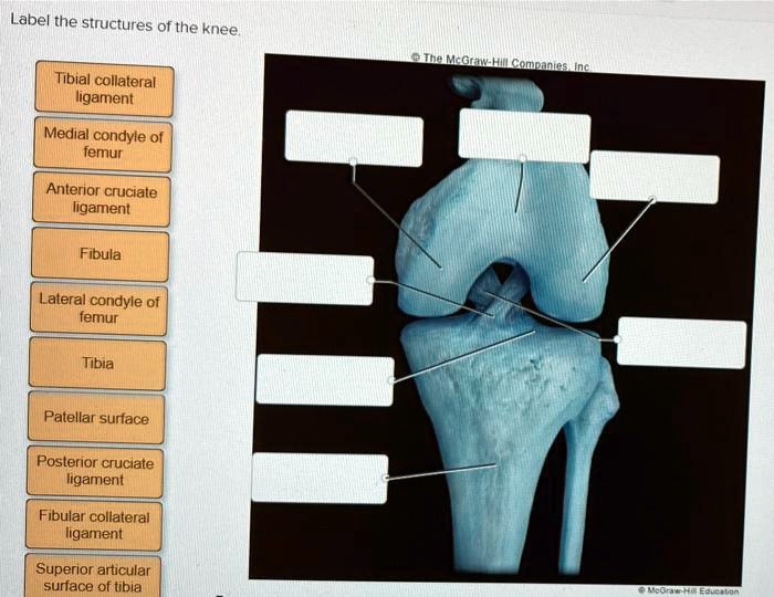 SOLVED: Label the structures of the knee Tibial collateral ligament ...
