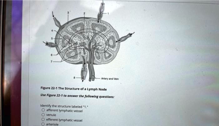 Artery and Vein Figure 22-1 The Structure of a Lymph Node Use Figure 22 ... Artery and Vein Figure 22-1 The Structure of a Lymph Node Use Figure 22 ...