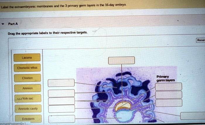SOLVED: Label the extraembryonic membranes and the 3 primary germ layers in the 16-day embryo ...