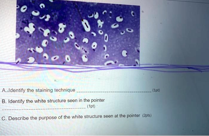 A. Identify the staining technique (1pt) B. Identify the white structure seen in the pointer ...