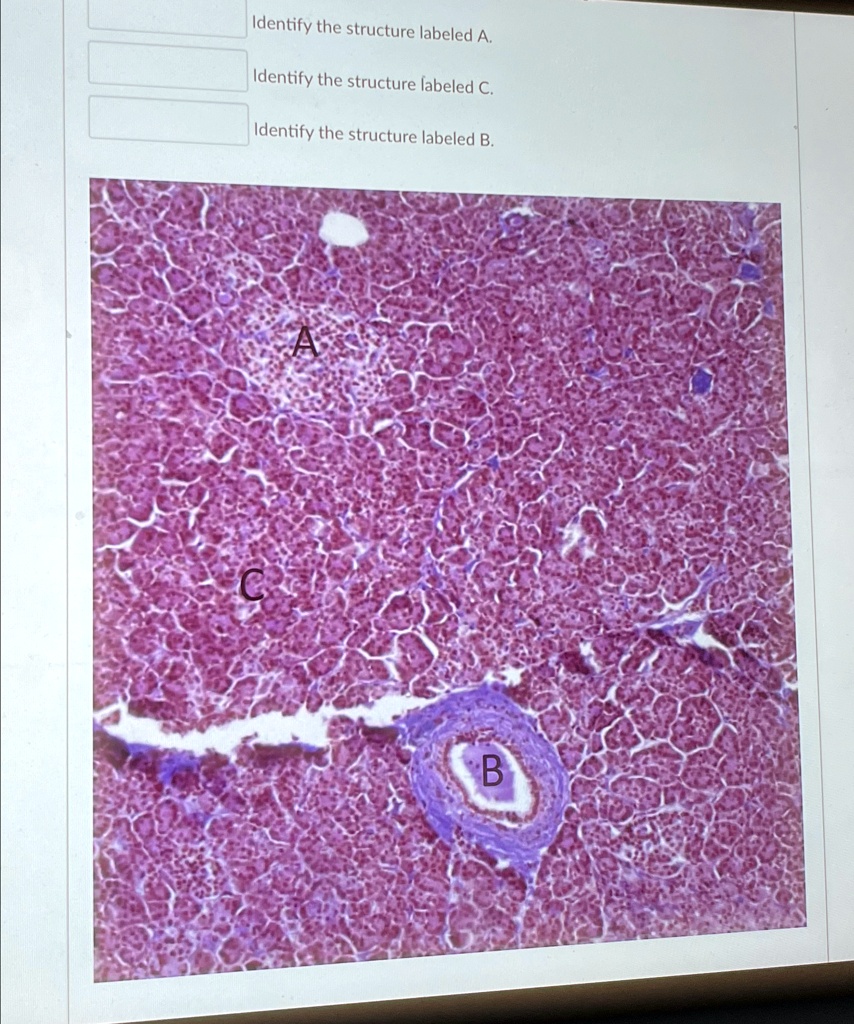 Identify the structure labeled A. Identify the structure labeled C. Identify the structure ...
