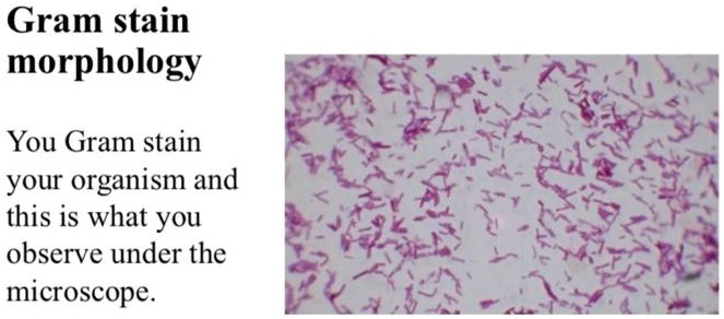 SOLVED: Gram stain morphology You Gram stain your organism and this is ...