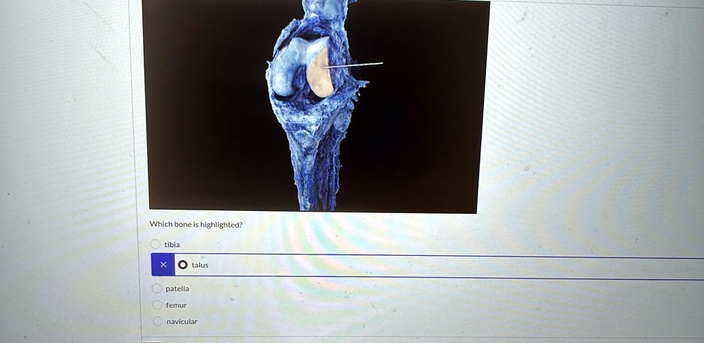 which bone is highlighted tibia talus patella femur navicular which ...