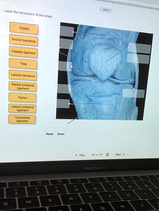Label the structures of the knee. Patella Medial meniscus Patellar ...