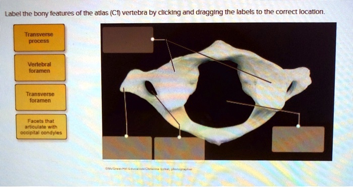 label the bony features of the atlas c1 vertebra by clicking and ...