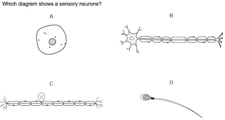 Which diagram shows a sensory neuron? A- B- C- D- Which diagram shows a ...