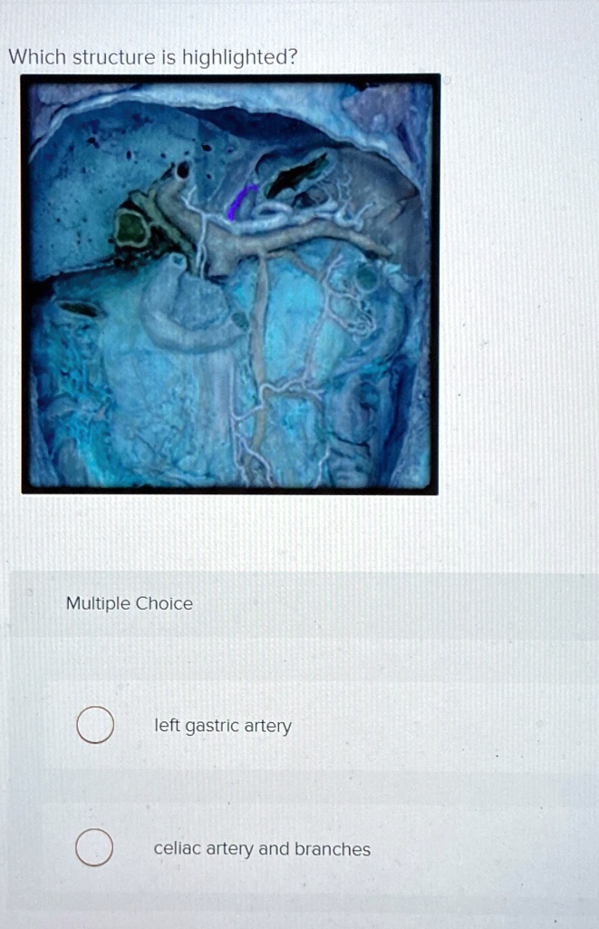 Which structure is highlighted? Multiple Choice left gastric artery ...
