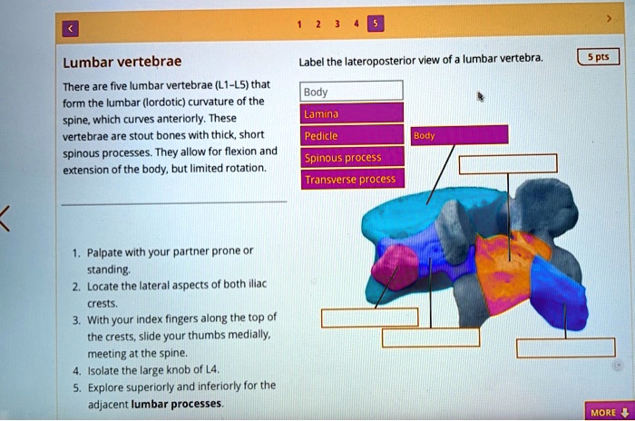 SOLVED: Lumbar vertebrae: There are five lumbar vertebrae (L1-L5) that ...