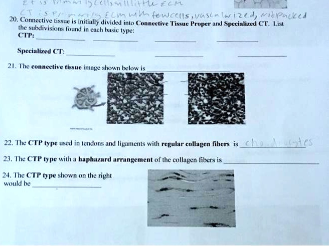 Et is Amaily cells mill little ECM 5, vascularized, Nodpacked CT IS Pay ...
