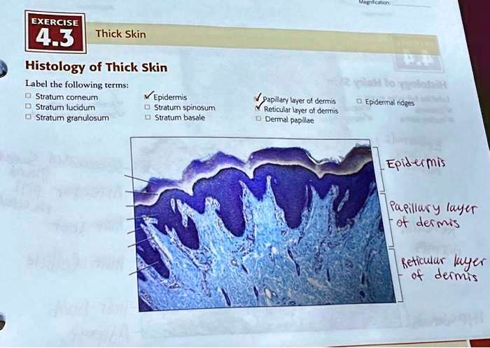 EXERCISE 4.3 Thick Skin Histology of Thick Skin Label the following ...