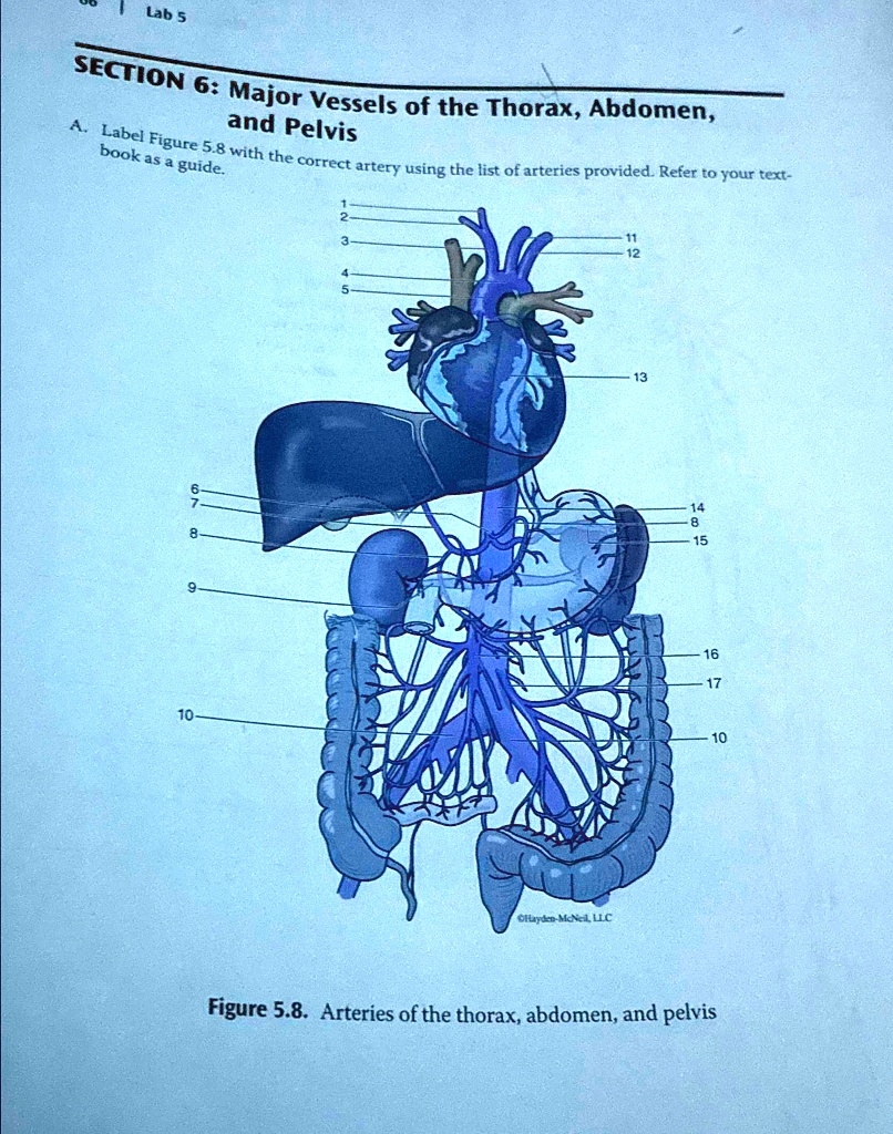 lab 5 section 6 major vessels of the thorax abdomen and pelvis a label ...