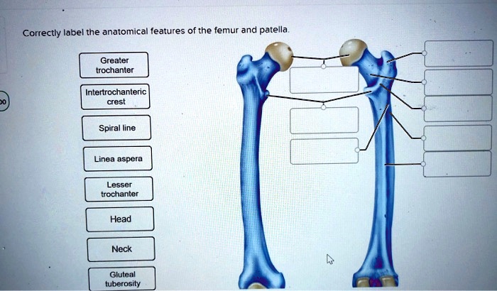 SOLVED: Correctly label the anatomical features of the femur and ...