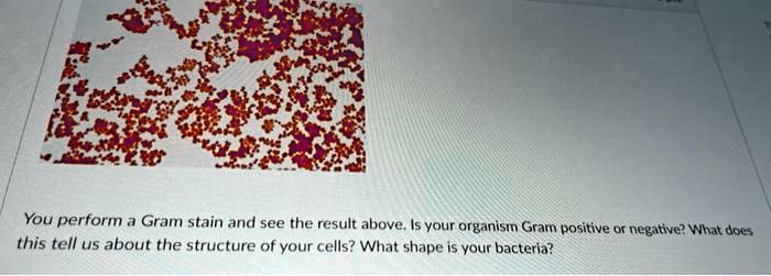 SOLVED: You perform a Gram stain and see the result above: Is your ...