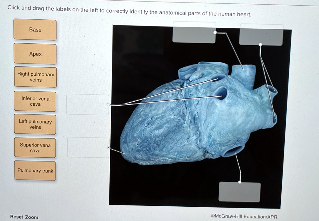 click and drag the labels on the left to correctly identify the ...