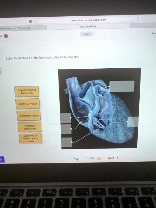 SOLVED: Title: Labeling the Features of the Heart Label the features of the heart using the ...