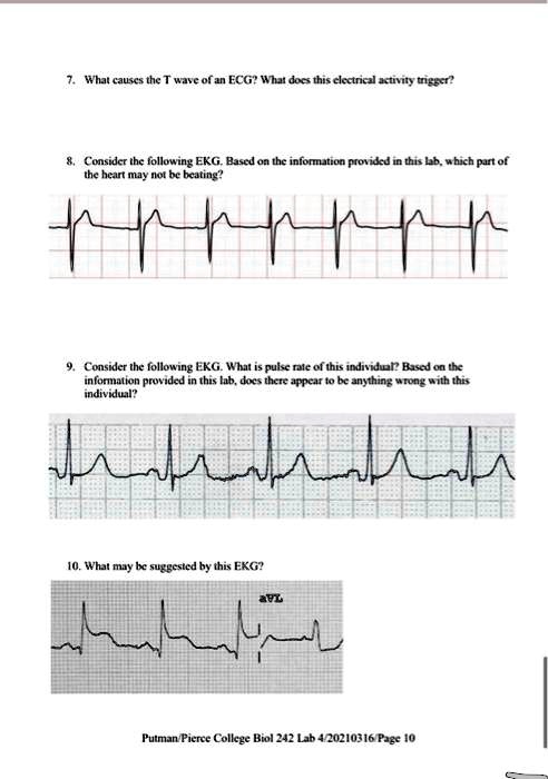 SOLVED: 7. What causes the T wave of an ECG? What does this electrical ...
