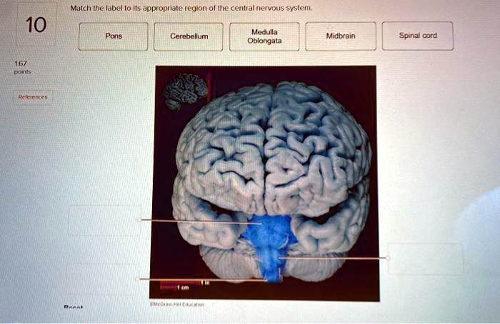 SOLVED: Match the label to its appropriate region of the central ...