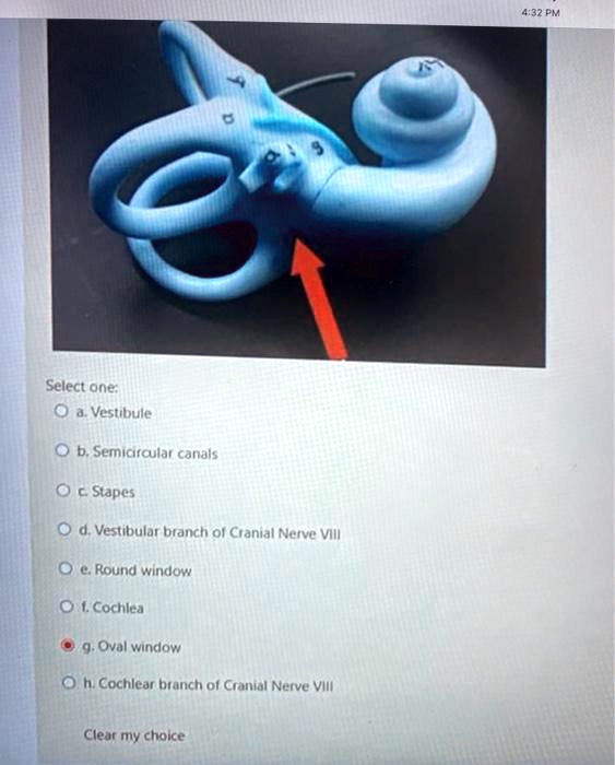 VIDEO solution: 4:32 PM Select one: a. Vestibule b. Semicircular canals ...