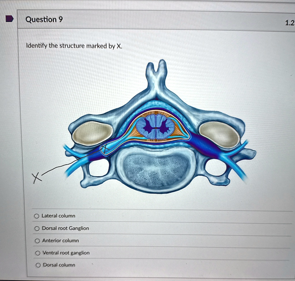 question 9 identify the structure marked by x lateral column dorsal ...