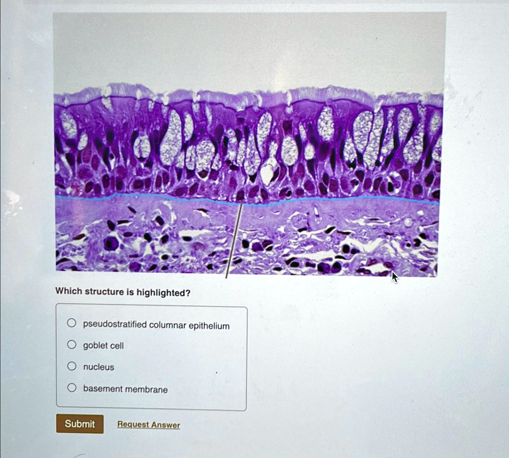 SOLVED: Which structure is highlighted? pseudostratified columnar epithelium goblet cell nucleus ...