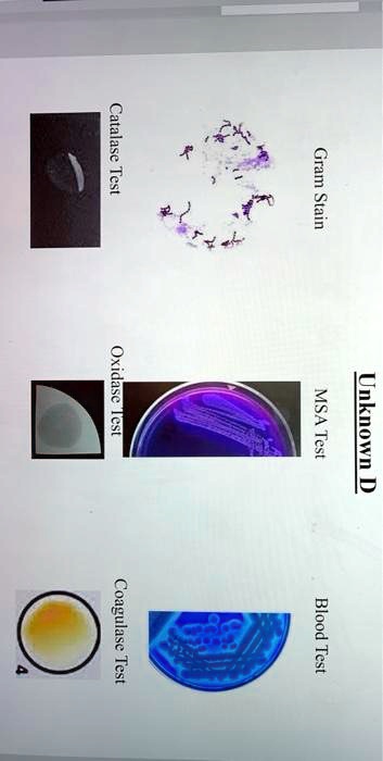 SOLVED:Catalase Test Gram Stain Oxidase 1S2L MSA Test [ Coagulase Test ...