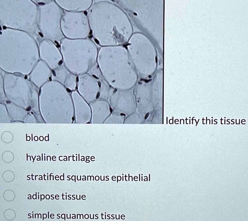 blood hyaline cartilage stratified squamous epithelial adipose tissue ...