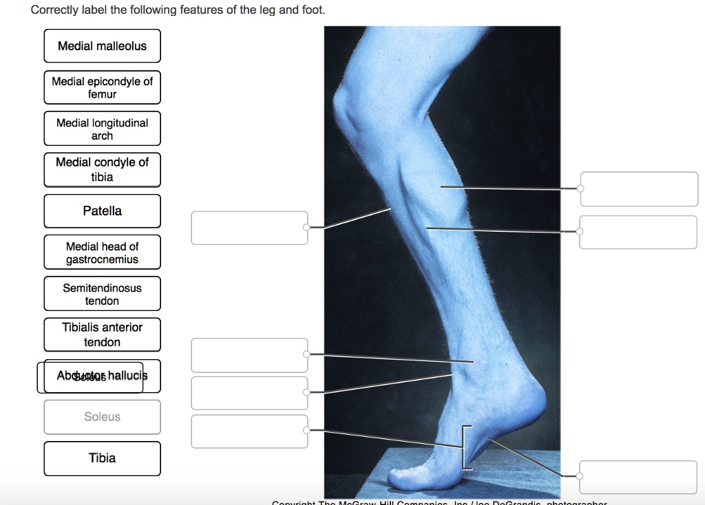 [GET ANSWER] correclty label the following feature of the leg and foot ...