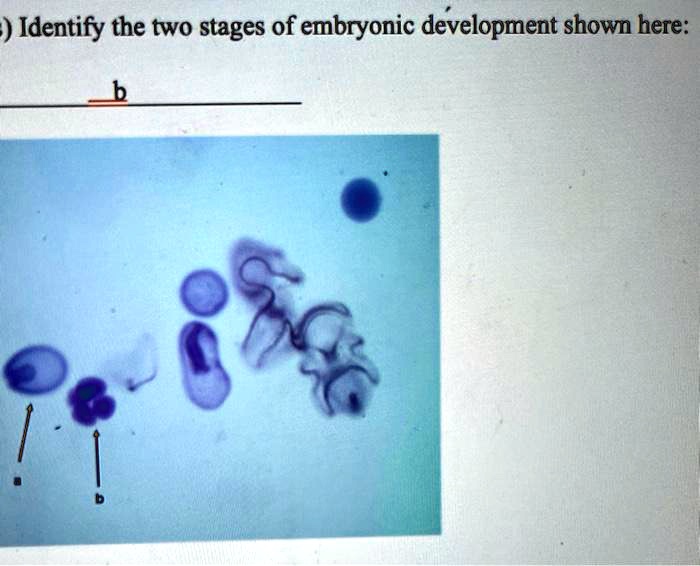 SOLVED: Identify the two stages of embryonic development shown here:
