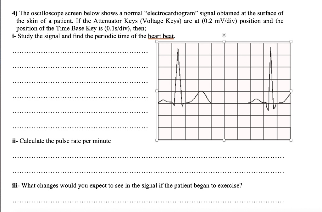SOLVED: The oscilloscope screen below shows a normal "electrocardiogram ...