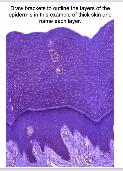 Draw brackets to outline the layers of the epidermis in this example of ...