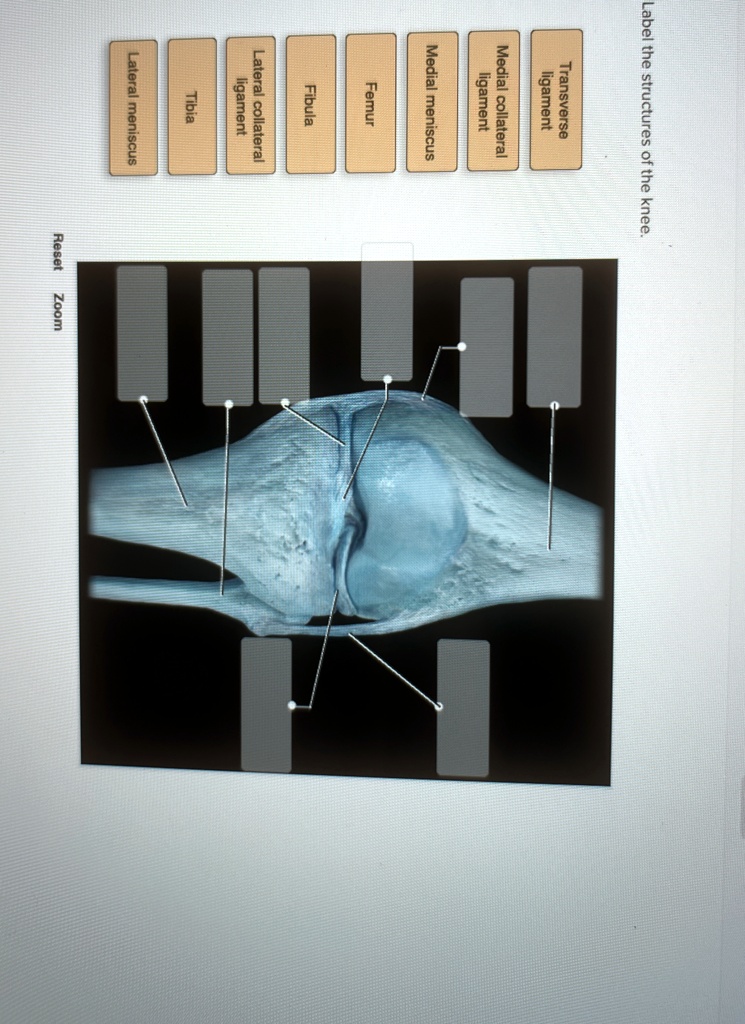 Label the structures of the knee. Transverse ligament Medial collateral ...