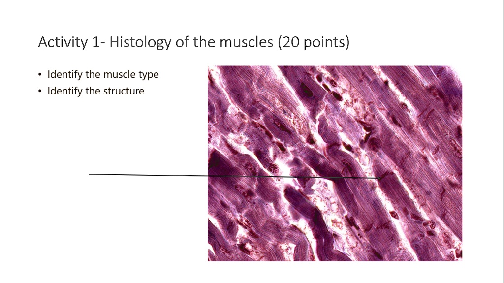 Identify the muscle labeled "1."Identify the muscle labeled "11 ...