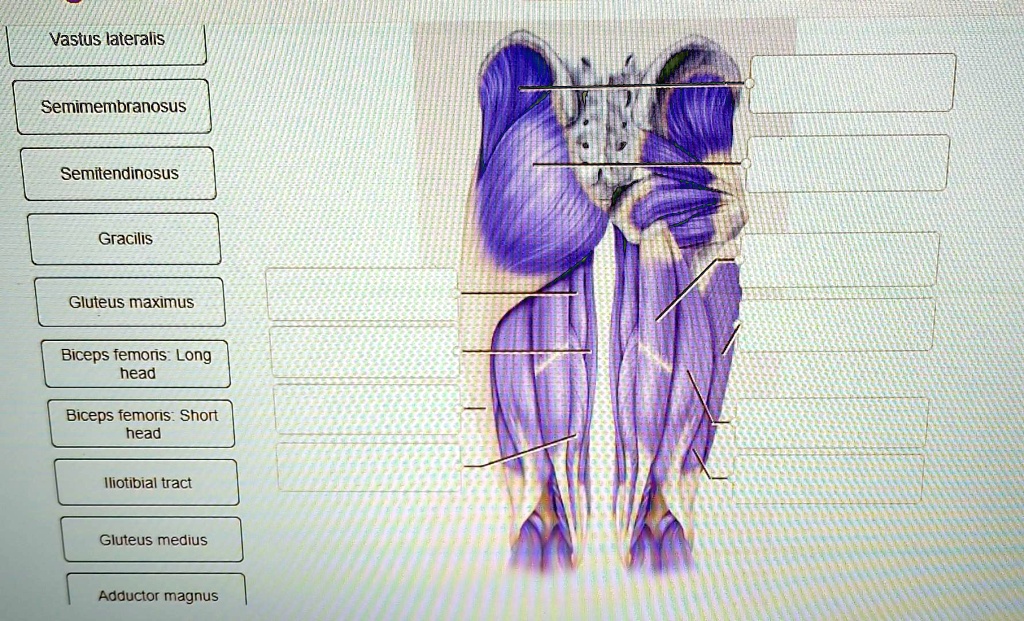 SOLVED: Vastus lateralis Semimembranosus Semitendinosus Gracilis ...