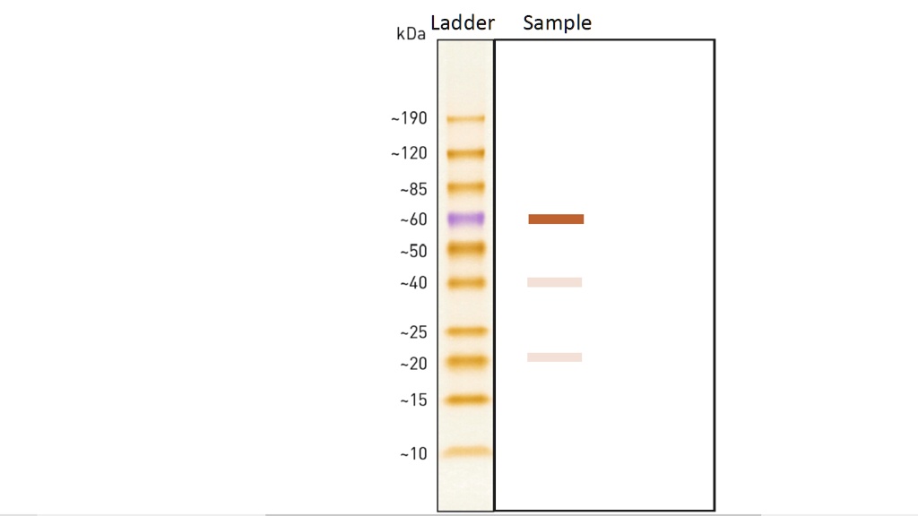 SOLVED: During the production of a protein that has 2 different ...
