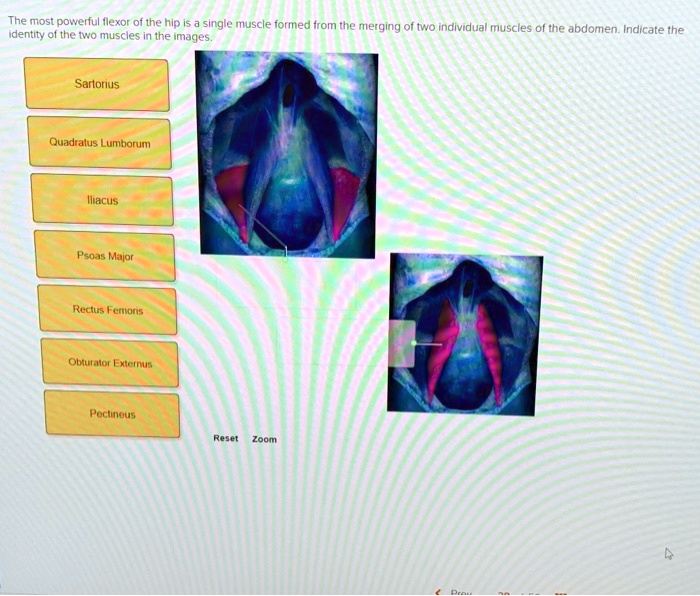 SOLVED: The most powerful flexor of the hip is a single muscle formed ...