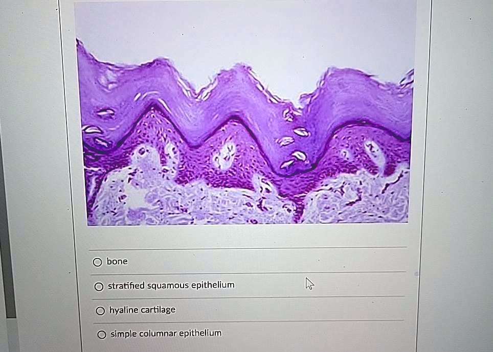 SOLVED: boneO stratified squamous epitheliumO hyaline cartilageO simple columnar epithelium O ...