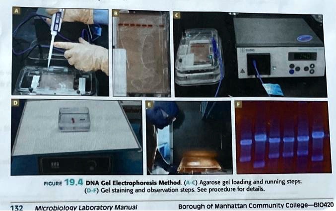 8 aun21j 194 dna gel electrophoresis method 4 c agarose gel loading and ...