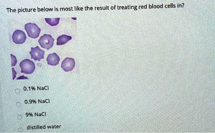 the picture below is most like the result of treating red blood cells ...