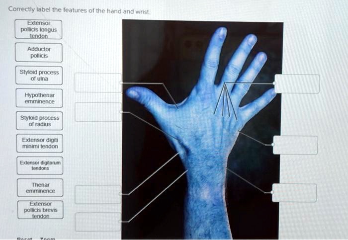 SOLVED: Correctly label the features of the hand and wrist: - Extensor ...
